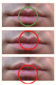 Embouchure ∣ Trumpet Academy